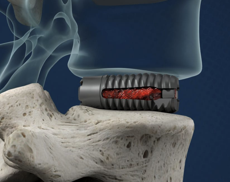 In 2018 Legacy Spine and Neurological Specialists and Scott Schlesinger ...